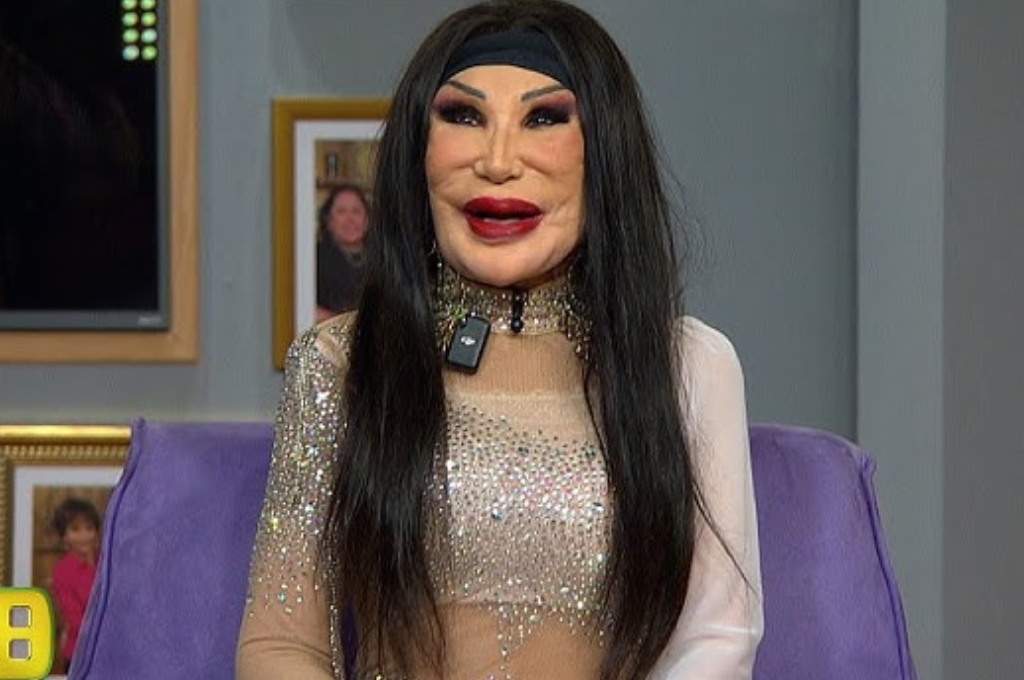 Fue viral por su “cabeza gigante”: ¿qué le pasó a Lyn May? – Notife